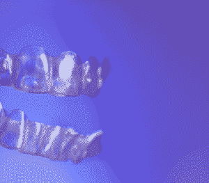 Angel Aligner: Invisalign Alternative Fr $2,000 • kohe™ Dental