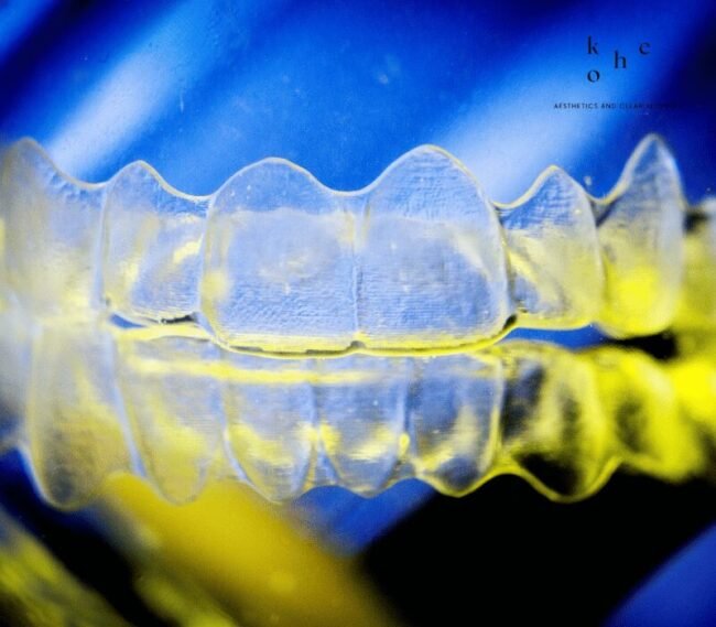 Clear Retainers: Retain Your Teeth @ $215 • kohe™ Dental