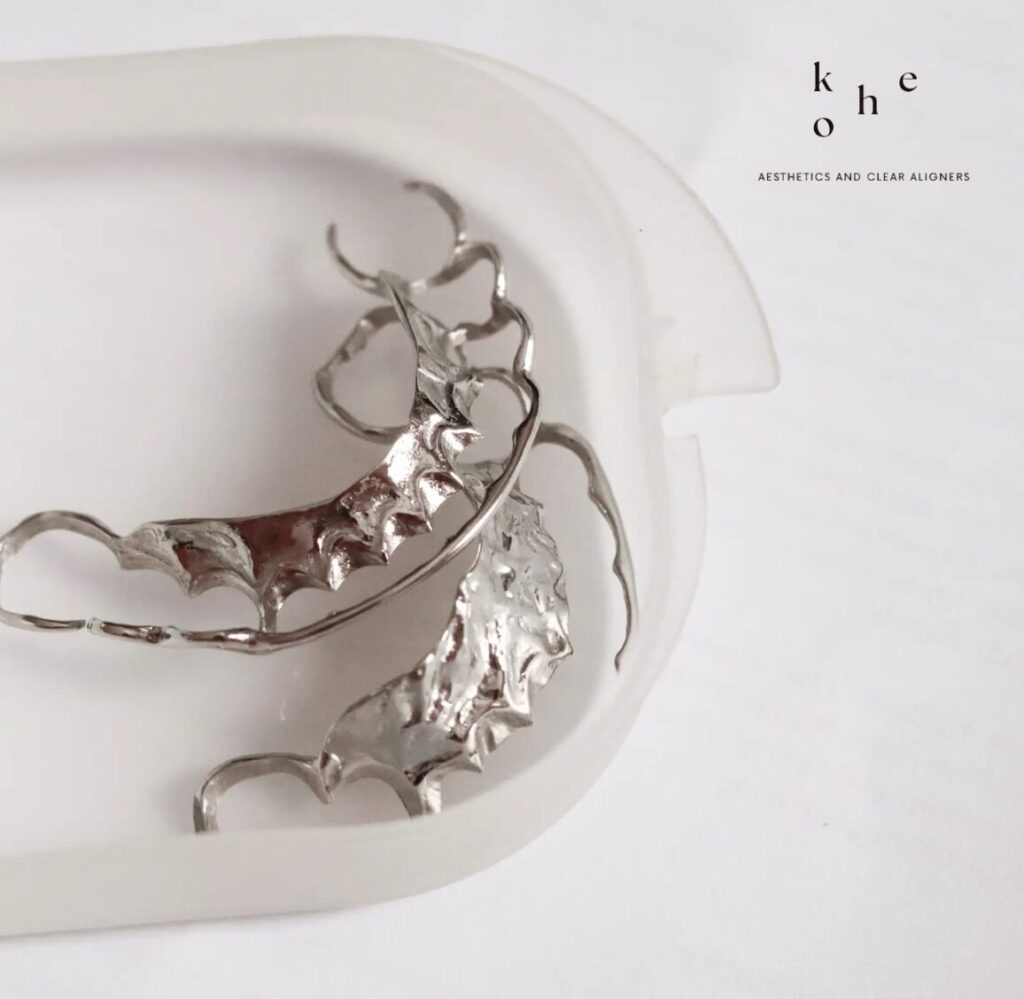 Metal Retainers: Secure Retainers From $225 • kohe™ Dental