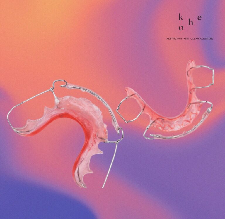 Metal Retainers: Secure Retainers From $225 • kohe™ Dental